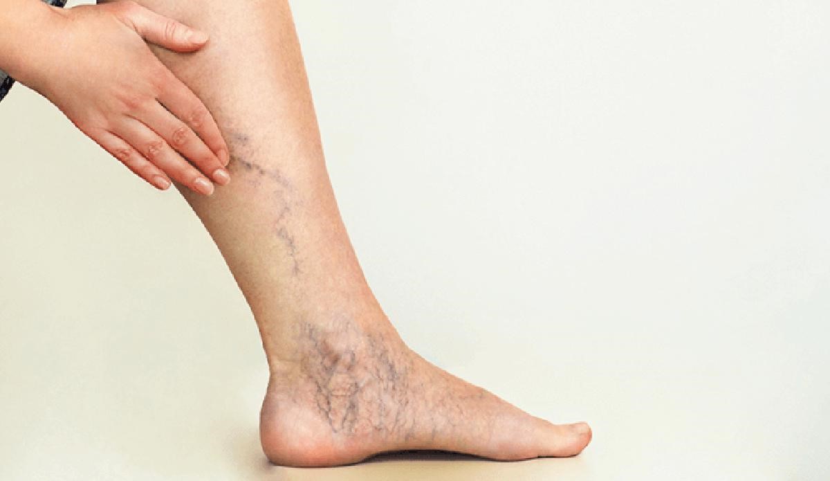 Varis Ne Demek? - Dr. Müge Afşar